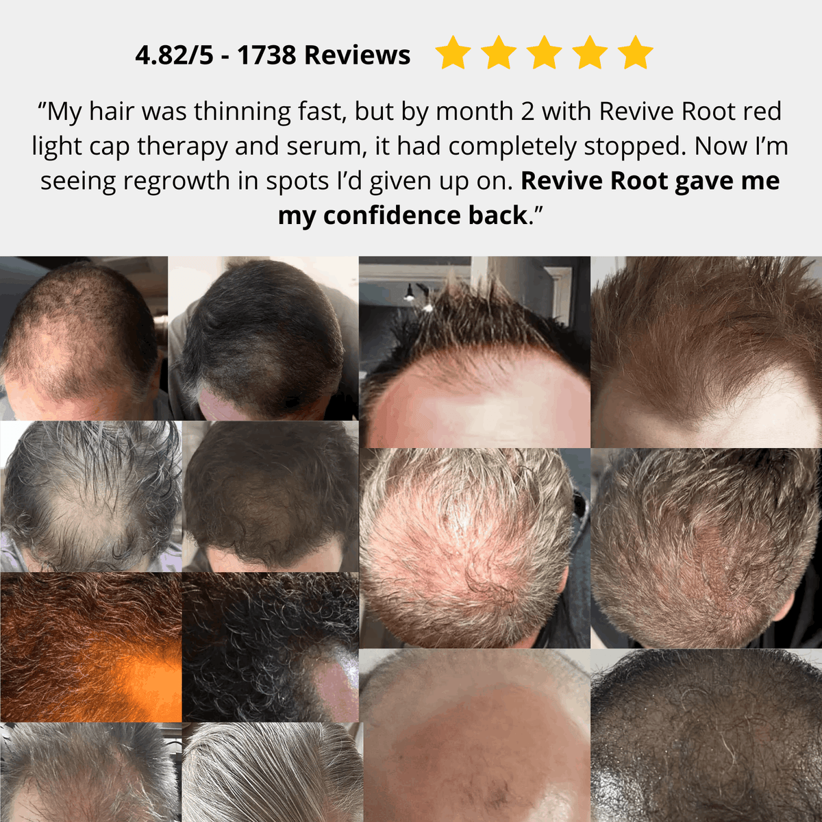 Red Light Therapy Cap for Hair Regrowth Treatments – ReviveRoot